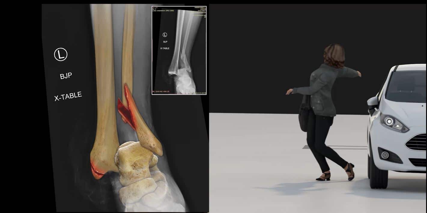 Panish | Shea | Ravipudi LLP Obtains $2.595 Million Award for ...